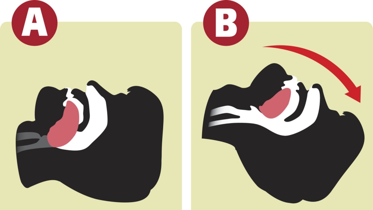 Choking Person Too Large? Use This Technique