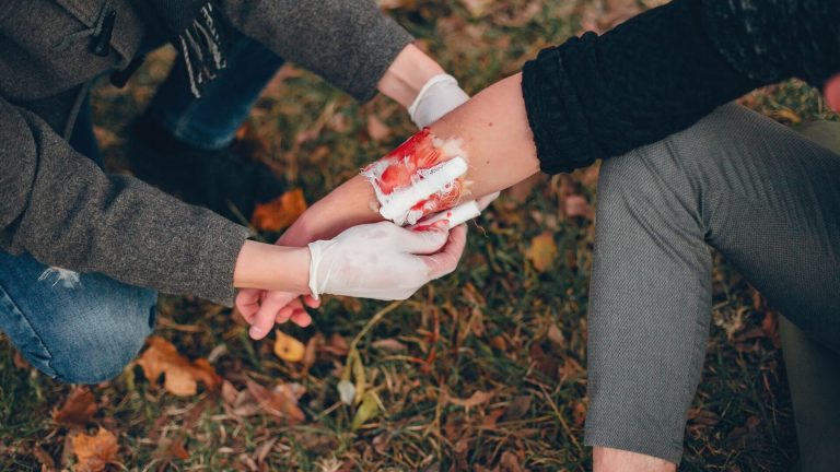 3rd Degree Burn: A Guide to First Aid & Treatment